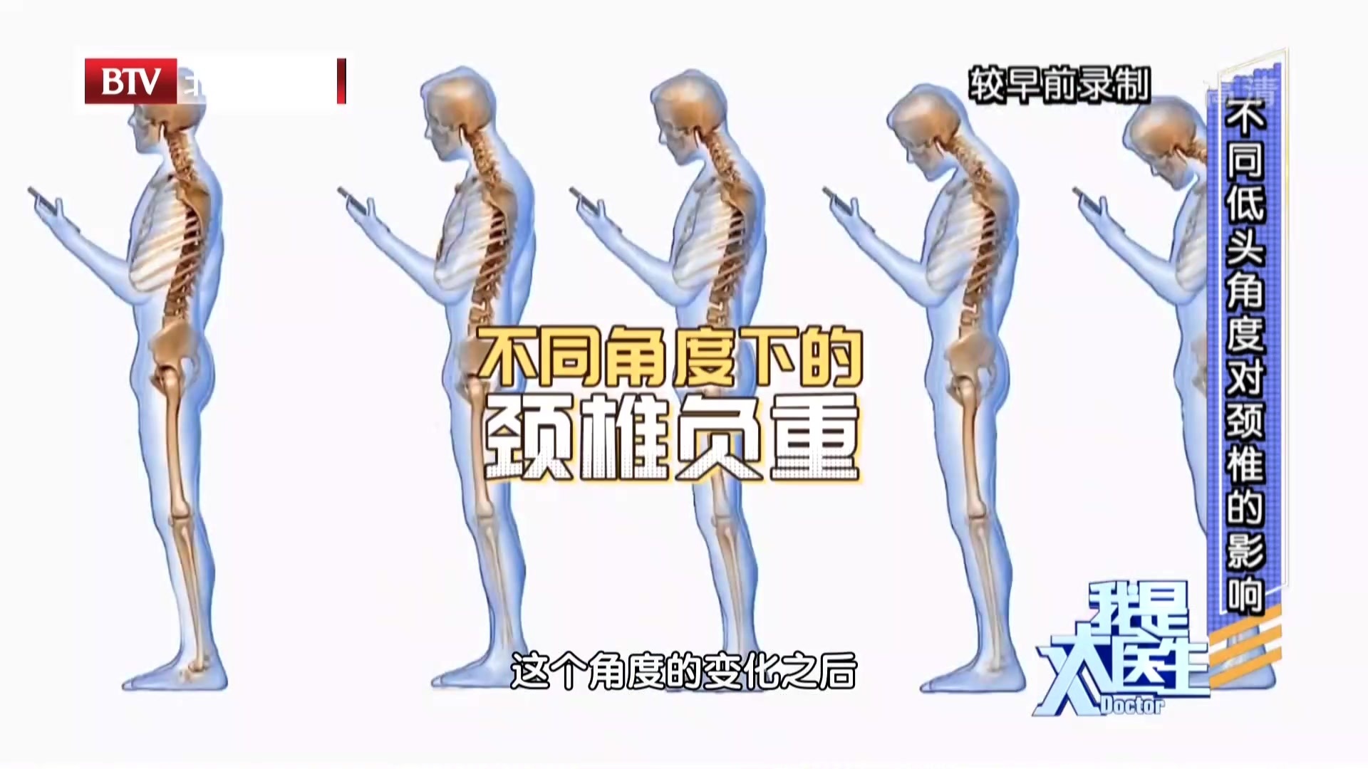 不同低头角度对颈椎的影响有何不同？_北京时间